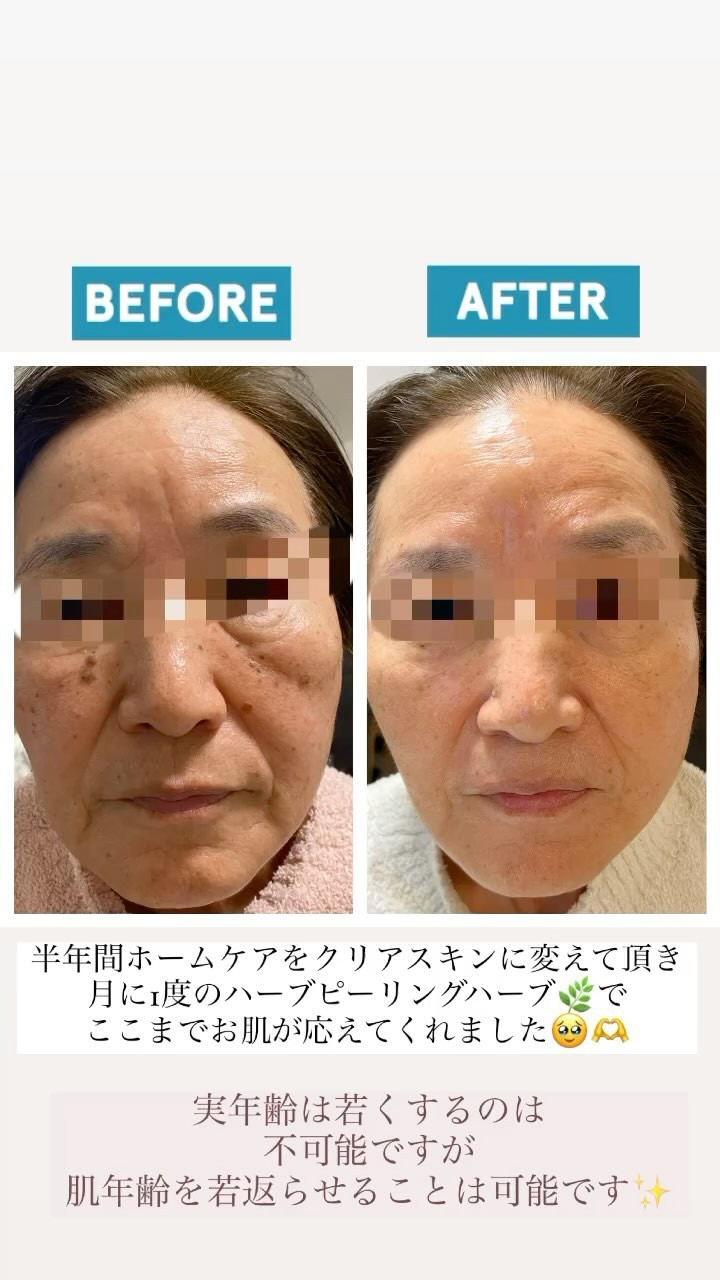 コツコツ | blog | 静岡県静岡市のエステならsalon ola